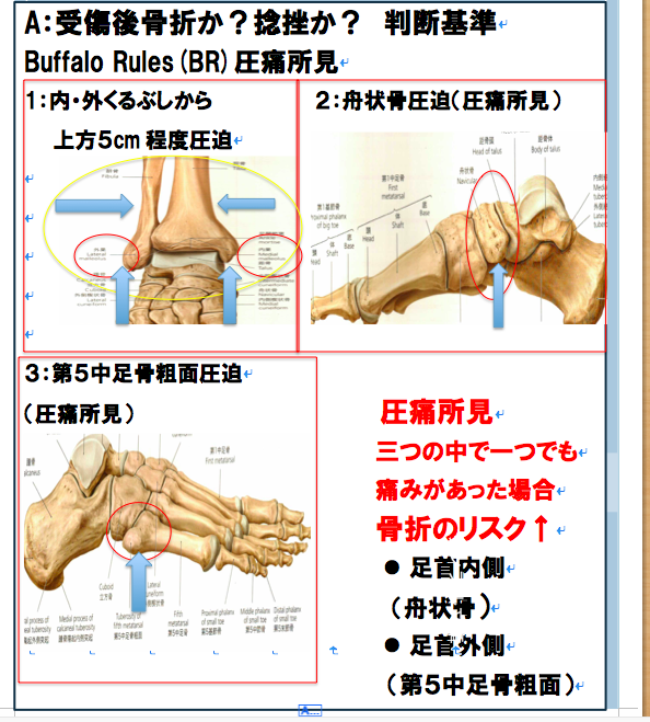 理学療法士・トレーナー向け！足関節捻挫のスポーツ現場での対応と評価方法 | RehaRock〜リハロック〜